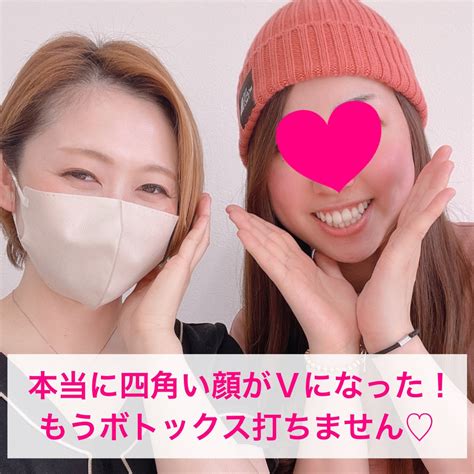 本当に四角い顔がvになった！もうボトックス打ちません♡【お客様の声】 【茨城 】エラ張り改善専門家 大賀未来 四角い顔をvにする