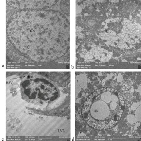 Transmission Electron Microscopy Image Of Mice Liver Note A Control