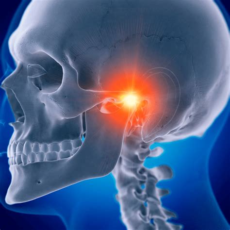 Sleep Bruxism The Ultimate Guide For Dentists Avant Dental