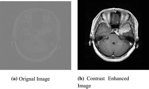 Result Of Contrast Enhancement Download Scientific Diagram