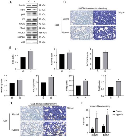 Inflammation And Coagulation Abnormalities Via The Activation Of The