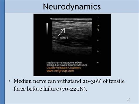 Neurodynamics Mobilization Of Nervous System Neural Mobilization Ppt