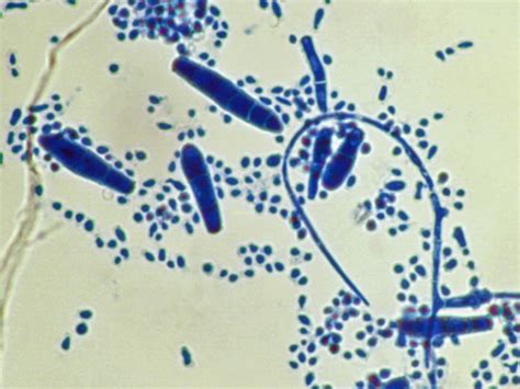 Trichophyton Mycology University Of Adelaide