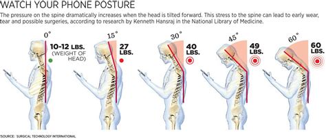 your texting and bad phone posture can wreck your spine trending