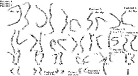 Screening For Subtelomeric Chromosome Alteration In A Consec
