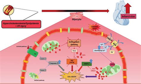 6 Hypercholesterolemia Dyslipidemia Effects On Ischemia Reperfusion