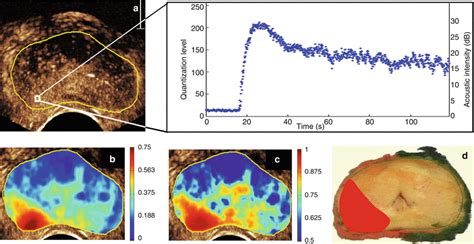 Contrast Enhanced Ultrasound Ceus And Elastographic Imaging