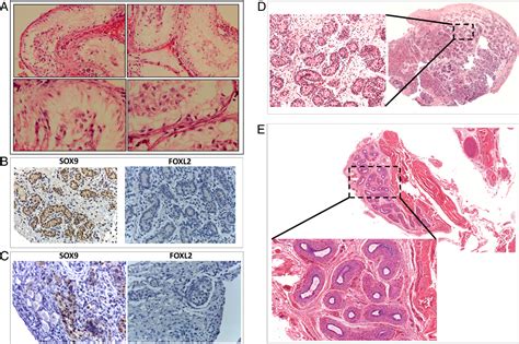 Figure 1 From Testis Formation In Xx Individuals Resulting From Novel