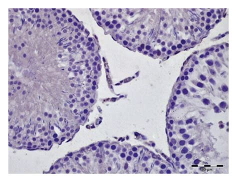 No A 3βhsd B Insl3 And C Gprc6a Immunoreactivity Was Observed
