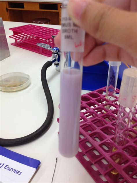 Rose And Lindseys Medical Microbiology Blog Litmus Milk Reactions