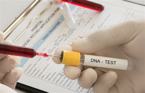 How Dna Tests Are Helping The Health Industry The Healthcare Guys