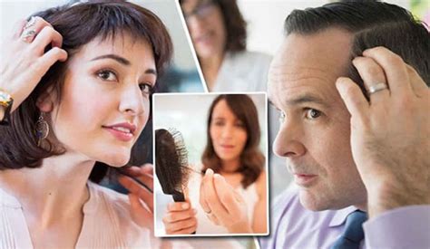 Male Or Female Pattern Baldness Causes And Baldness Treament