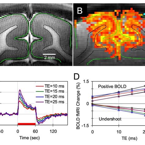 Te Dependence Of Bold Fmri Signals T 1 Weighted Anatomical Image A