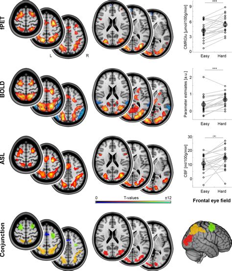 Reconfiguration Of Functional Brain Networks And Metabolic Cost