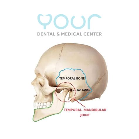 Temporomandibular Disorder Tmd