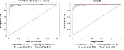 Figure 1 From Brain Tumour Detection From Magnetic Resonance Imaging