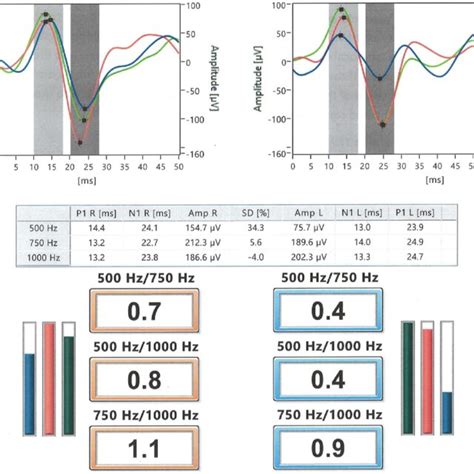 Example Of Typical Cvemps Tuning Where The Highest Amplitude Of P13 To