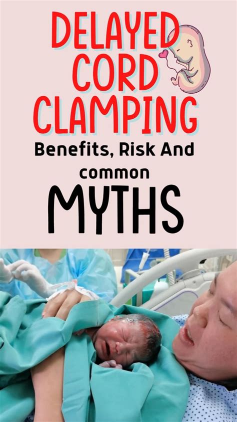 Benefits Risk And Myths About Delayed Cord Clamping Artofit
