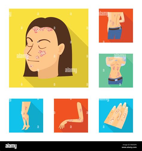Skin Rash Back Cut Out Stock Images And Pictures Alamy
