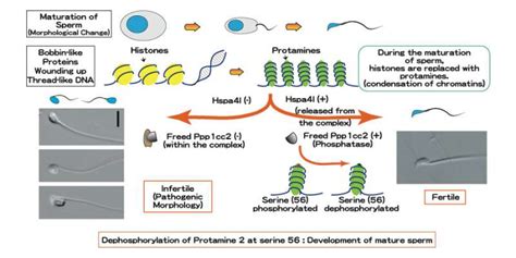 Infertilitys Roots In Dna Packaging