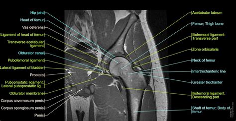 The Hip Anatomy On 3t Mr And 3d Pictures E Anatomy