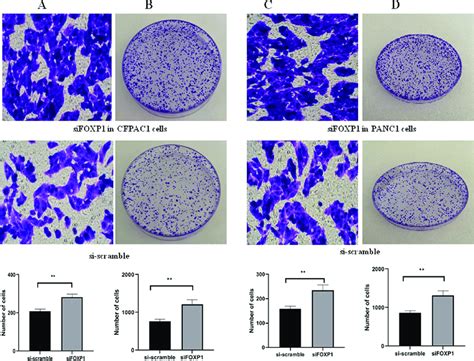 Low Foxp1 Expression Promoted The Proliferation Migration And