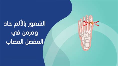 Microbe Mus Lure اعراض آلام المفاصل والعضلات Cane In Fact Sake