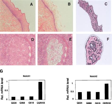 Specific Down Modulation Of Notch1 Signaling In Cervical Cancer Cells