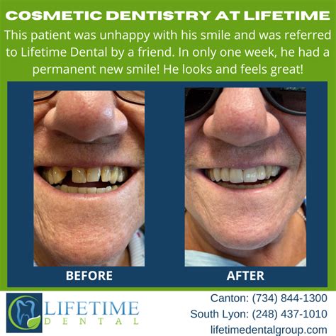 Options For Replacing A Missing Tooth Lifetime Dental Group