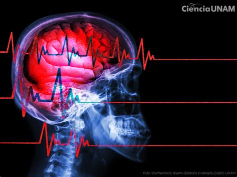 Muerte Encefalica Diagnostico De Muerte Encefalica Por Doppler