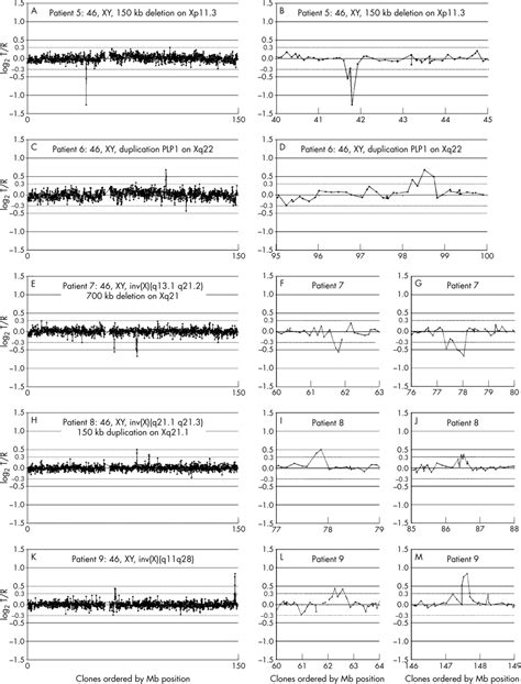 high resolution profiling of x chromosomal aberrations by
