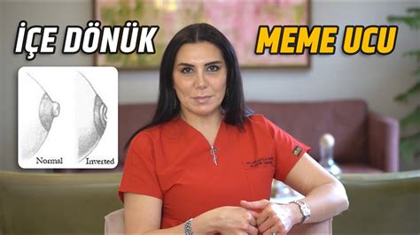 Meme Ucu EstetİĞİ İÇe DÖnÜk Meme Ucu Op Dr Leyla Arvas Youtube