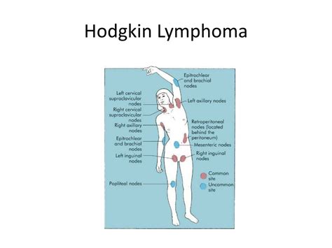 Ppt Alterations Of Hematologic Function Powerpoint Presentation Free