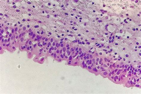 Transitional Epithelium Labeled Diagram