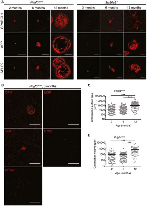 Calcifications In Pdgfbret Ret And Slc20a2− − Mice Grow In Size And