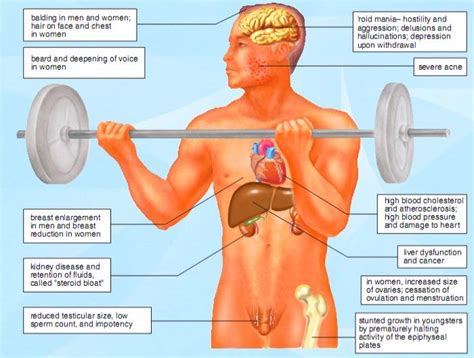 Side Effects Of Anabolic Steroids – Medchrome