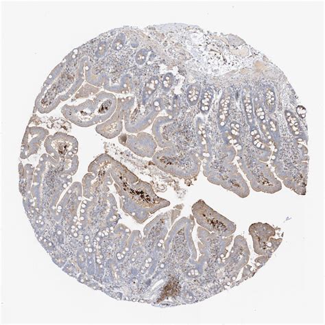 Tissue Expression Of Kynu Staining In Duodenum The Human Protein Atlas