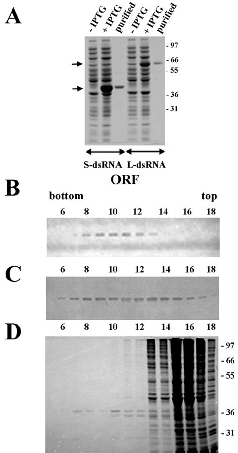 Electron Micrograph Of Vlps From Fraction 10 Fig 3 Of Cscl Gradient