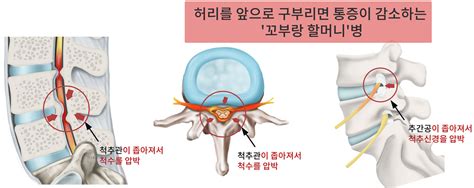 대구한방병원 수월한방병원｜척추관절치료 교통사고후유증 수술후재활