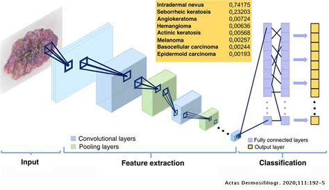 deep learning and mathematical models in dermatology actas dermo