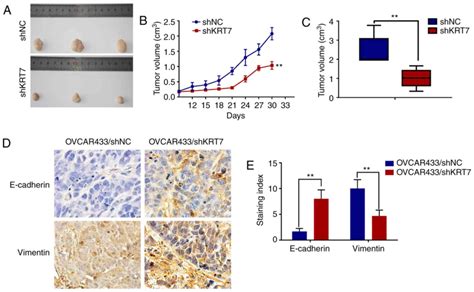 Krt7 Promotes Epithelial‑mesenchymal Transition In Ovarian Cancer Via