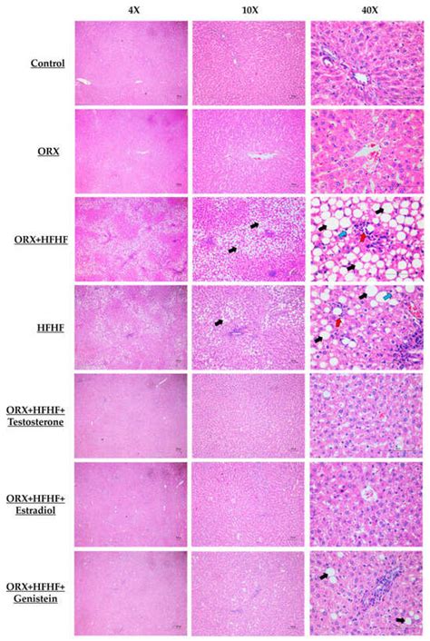 Biomedicines Free Full Text Genistein And Sex Hormone