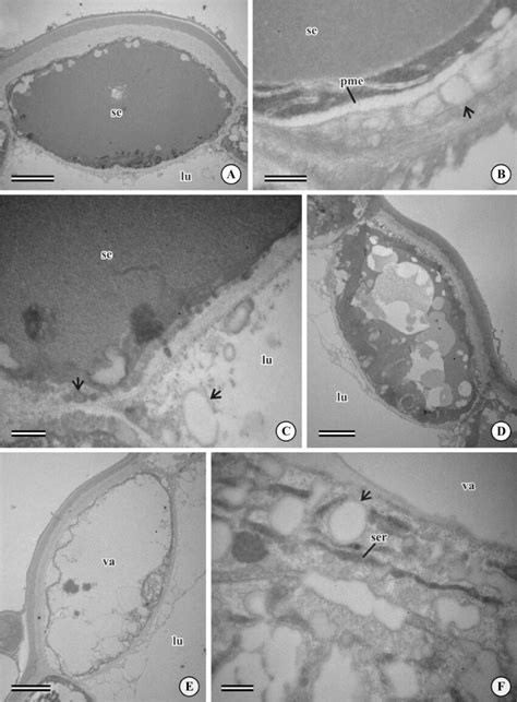 Ultrastructure Tem Of The Cavitated Trichome Secretory Cells Of