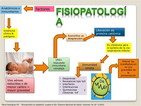 Bronquiolitis Pediatría