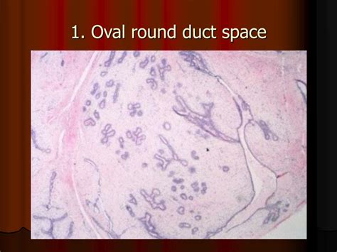 Ppt Breast Disease Powerpoint Presentation Free Download Id 1368363