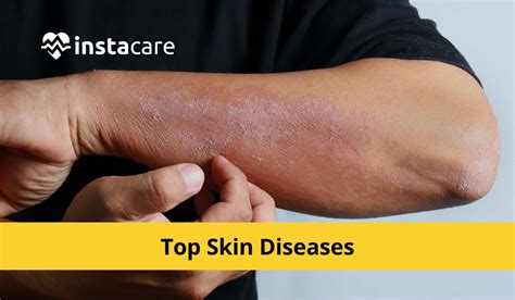 Most Common Skin Conditions And How To Treat Them Skin Rash Itchy Skin