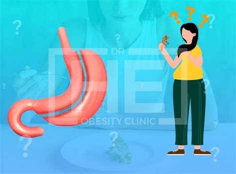 What To Do If You Overeat After Gastric Sleeve Dr He Obesity Clinic
