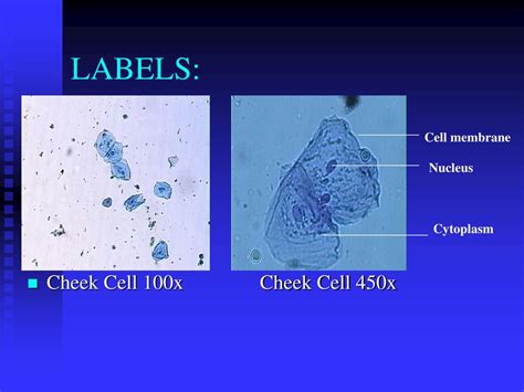 Cheek Cells Under Microscope Labeled
