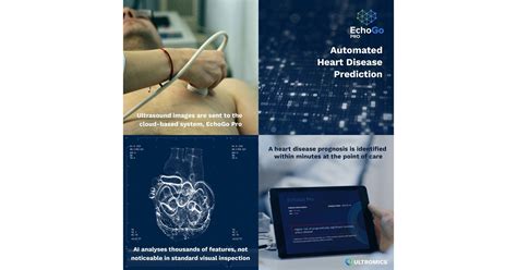 Ultromics Develops World First Ai Technology That Can Predict Heart Disease