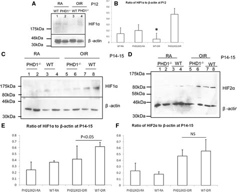 Expression Of Hif 1 And Hif2 Protein In Phd1 And Wt Mice In The